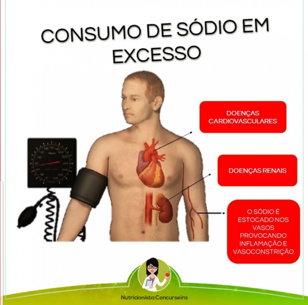 Resumo de Sódio: Consumo em excesso | Nutrição | Sanar Saúde